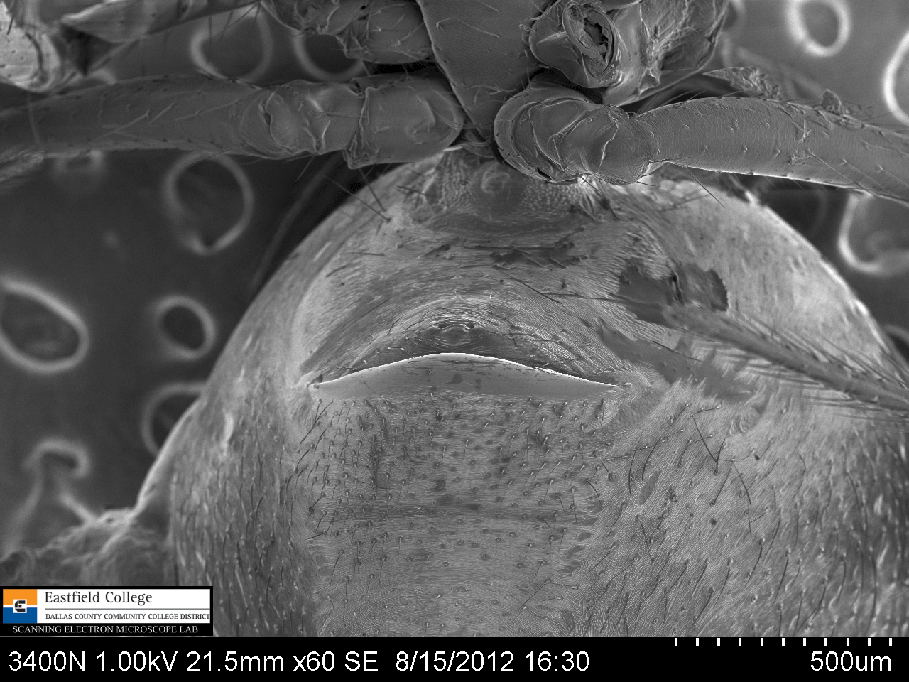 Scanning Electron Microscope Blog: Itsy Bitsy Spider - The Scanning ...