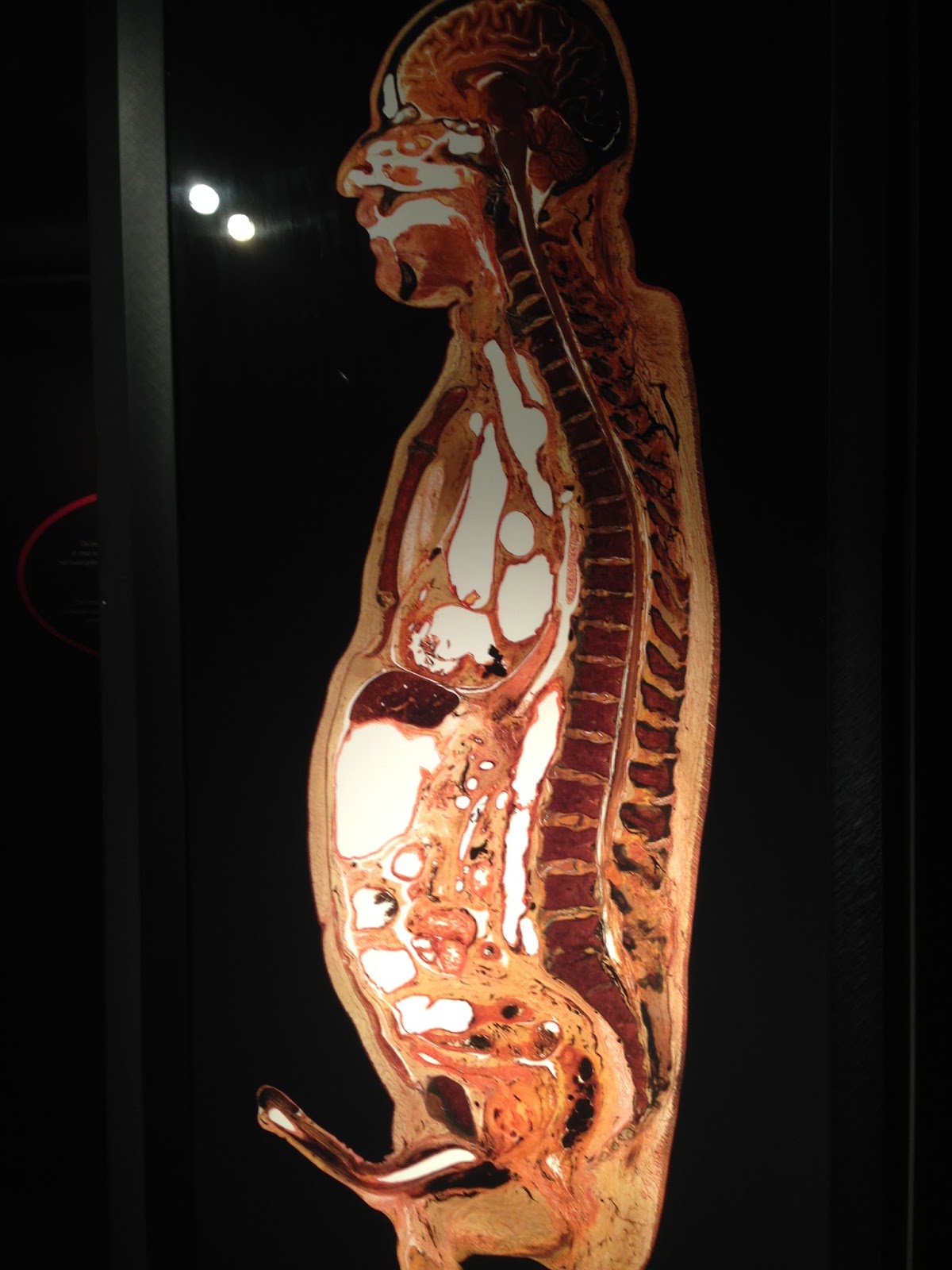 Photo weblog Arash sametipour : Body World Amsterdam