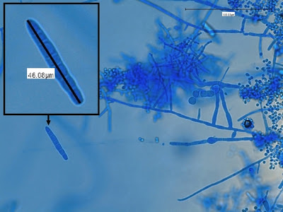 Fun With Microbiology (What's Buggin' You?): Trichophyton ...