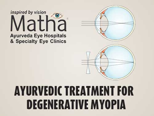 Matha Ayurveda Eye hospital