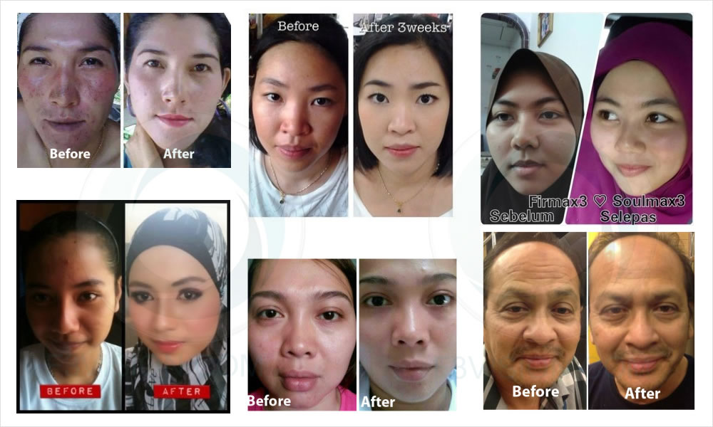 Testimoni dan Cara Pemakaian Firmax3 Untuk Wajah