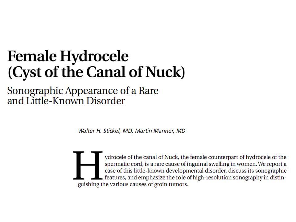 BÀI SOẠN VỀ SIÊU ÂM CHẨN ĐOÁN: FEMALE HYDROCELE [CYST of the CANAL of NUCK]