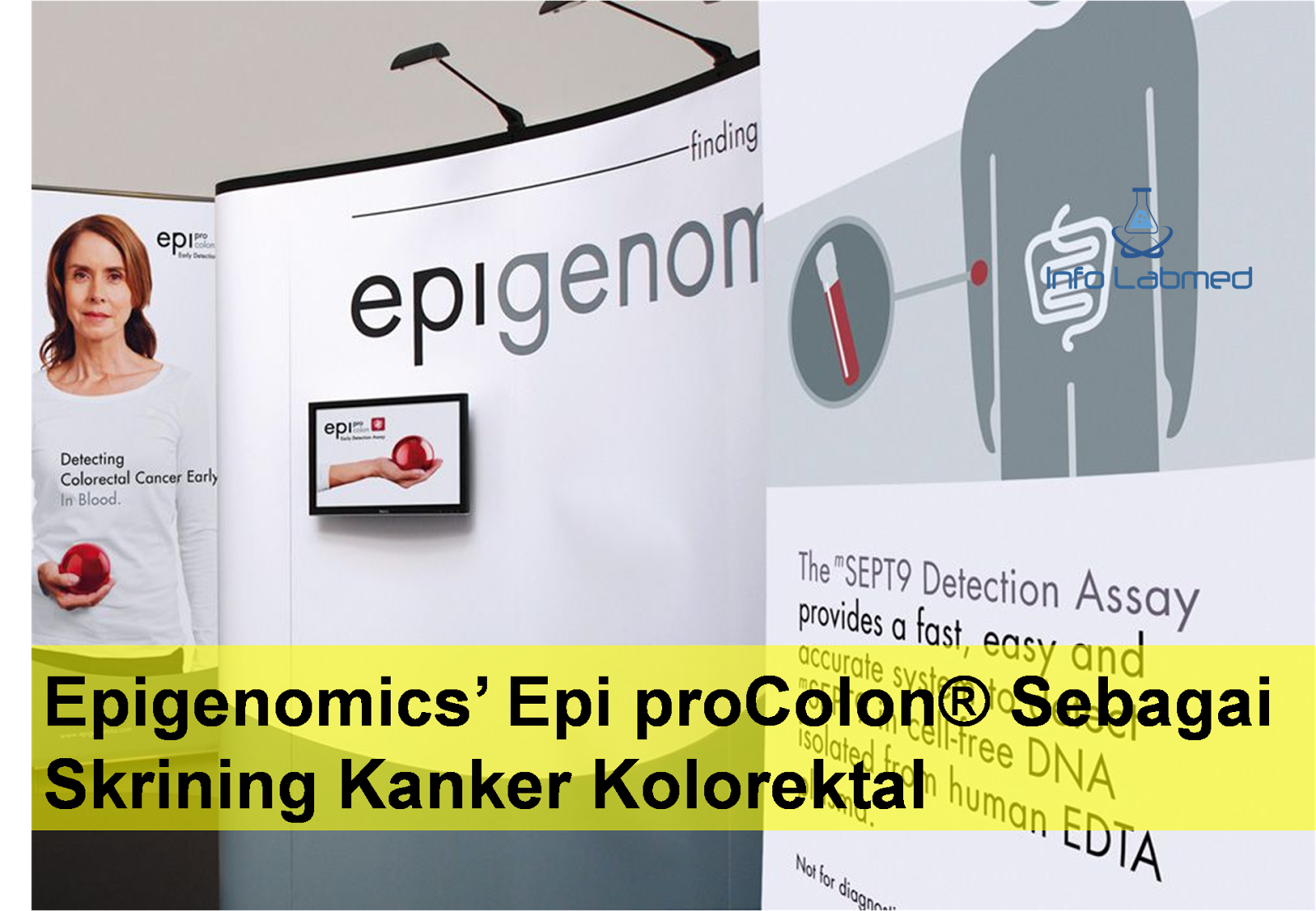 Epigenomics’ Epi proColon® Baru Saja Mengeluarkan Pedoman Dalam USPSTF ...