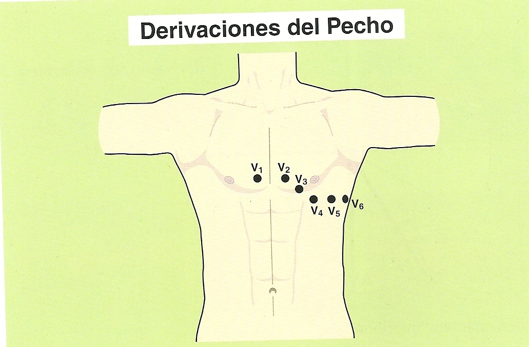 Electrocardiograma: Derivaciones en el ECG