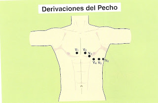 Electrocardiograma: Derivaciones en el ECG