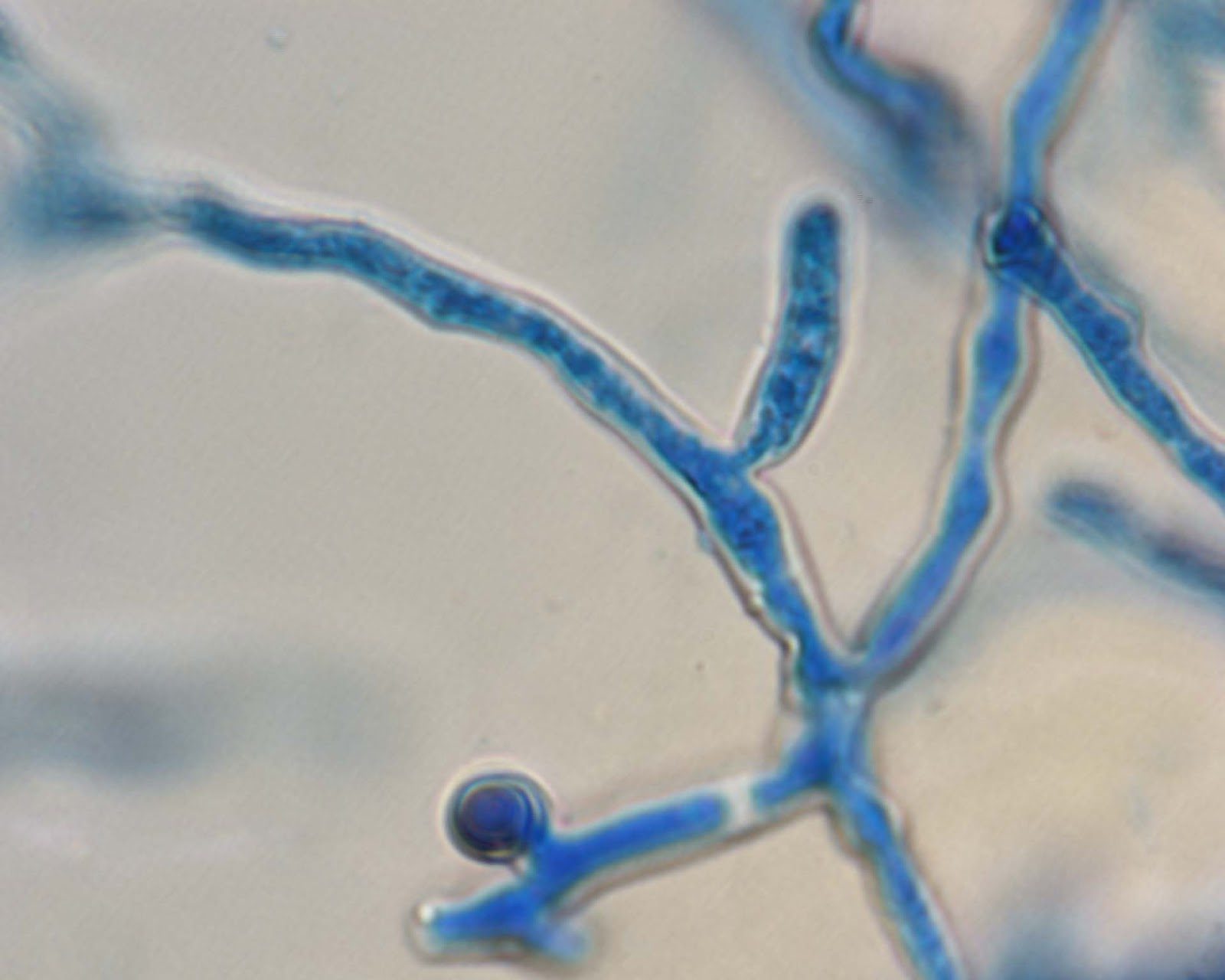Pythium insidiosum photo collection