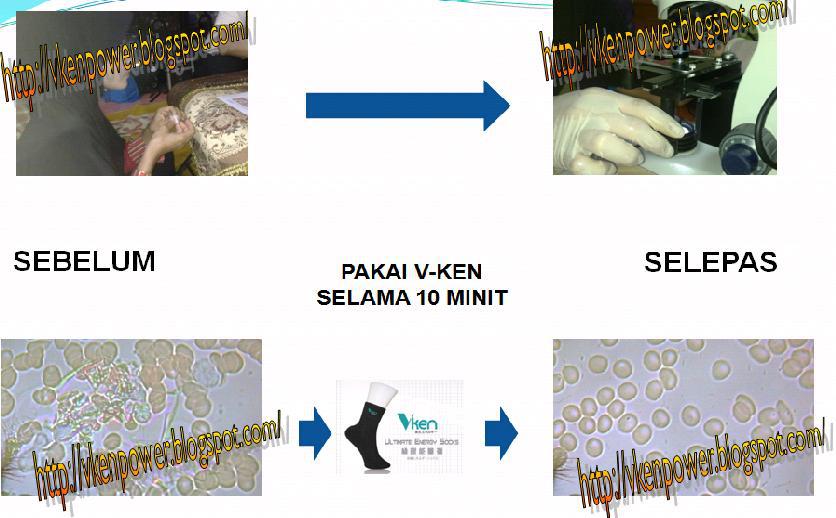 Vken Ultimate (Stokin Ajaib)