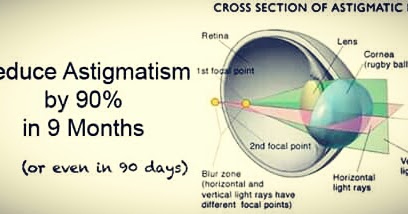 ဗဟုသုတအစံု: သူငယ္အိမ္ ေစာင္းျခင္း နဲ႔ ပ်င္းတဲ့မ်က္စိ..Astigmatism and ...