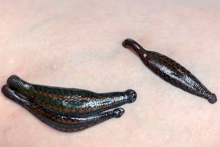 7 Surprising Health Benefits That Come From Leech Therapy ~ MGT