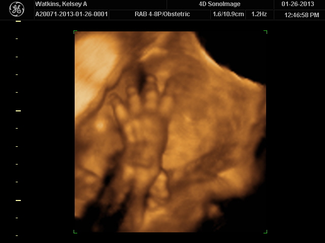 Hello, Bebe Watkins!: 4D Ultrasound | 31 Weeks