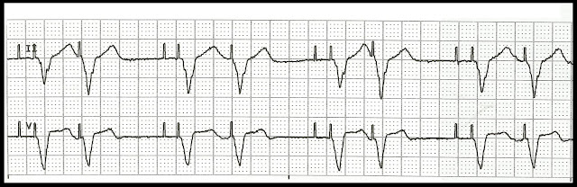 Basic EKG Rhythm Test 01