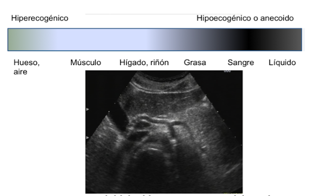 Ecografía: FORMACIÓN DE LA IMAGEN ECOGRÁFICA (Ecogenicidad de los tejidos)