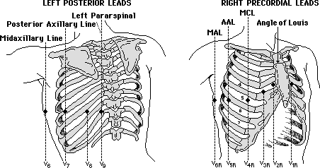 Lead EKG Posterior | INA - ECG