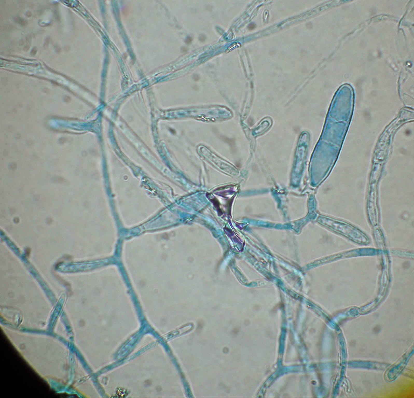 ATLAS MICOLOGIA: EPIDERMOPHYTON FLOCCOSUM