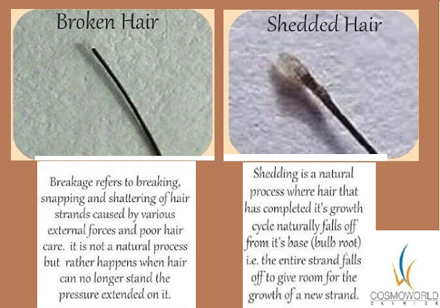 Cosmoworld Clinics Difference Between Hair Loss And Breakage cosmoworld-clinics-difference-between-hair-loss-and-breakage