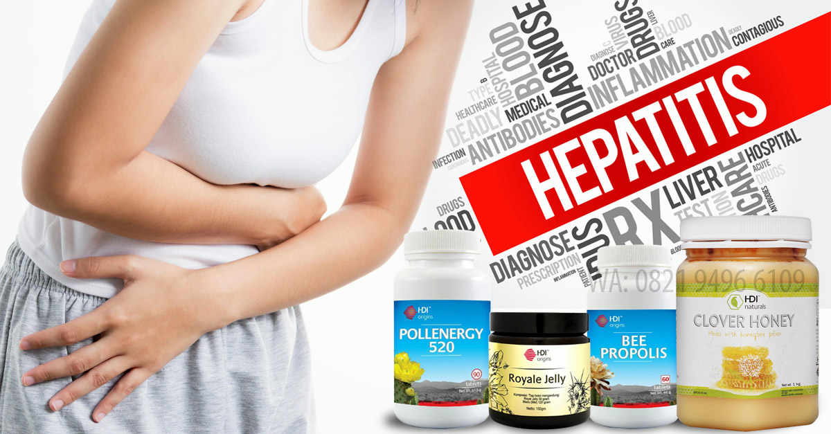 Hepatitis - Radang Hati | Madu Asli - High Desert