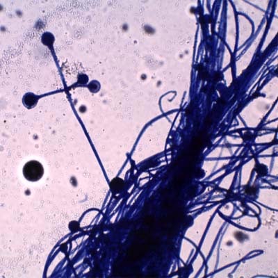 Sustainable Mycology: Absidia spp.