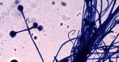 Sustainable Mycology: Absidia spp.