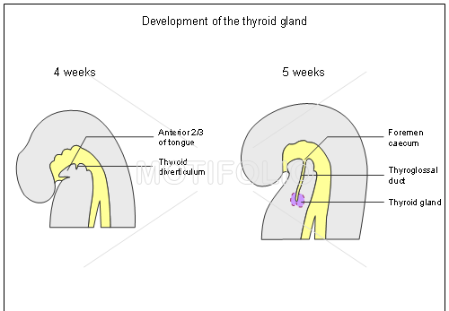 Prepare for Medical Exams : Ectopic Thyroid Gland