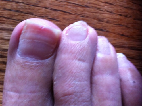 Thrilled to Death: Paul Pavao's Leukemia Blog: Chemo Lines Revisited