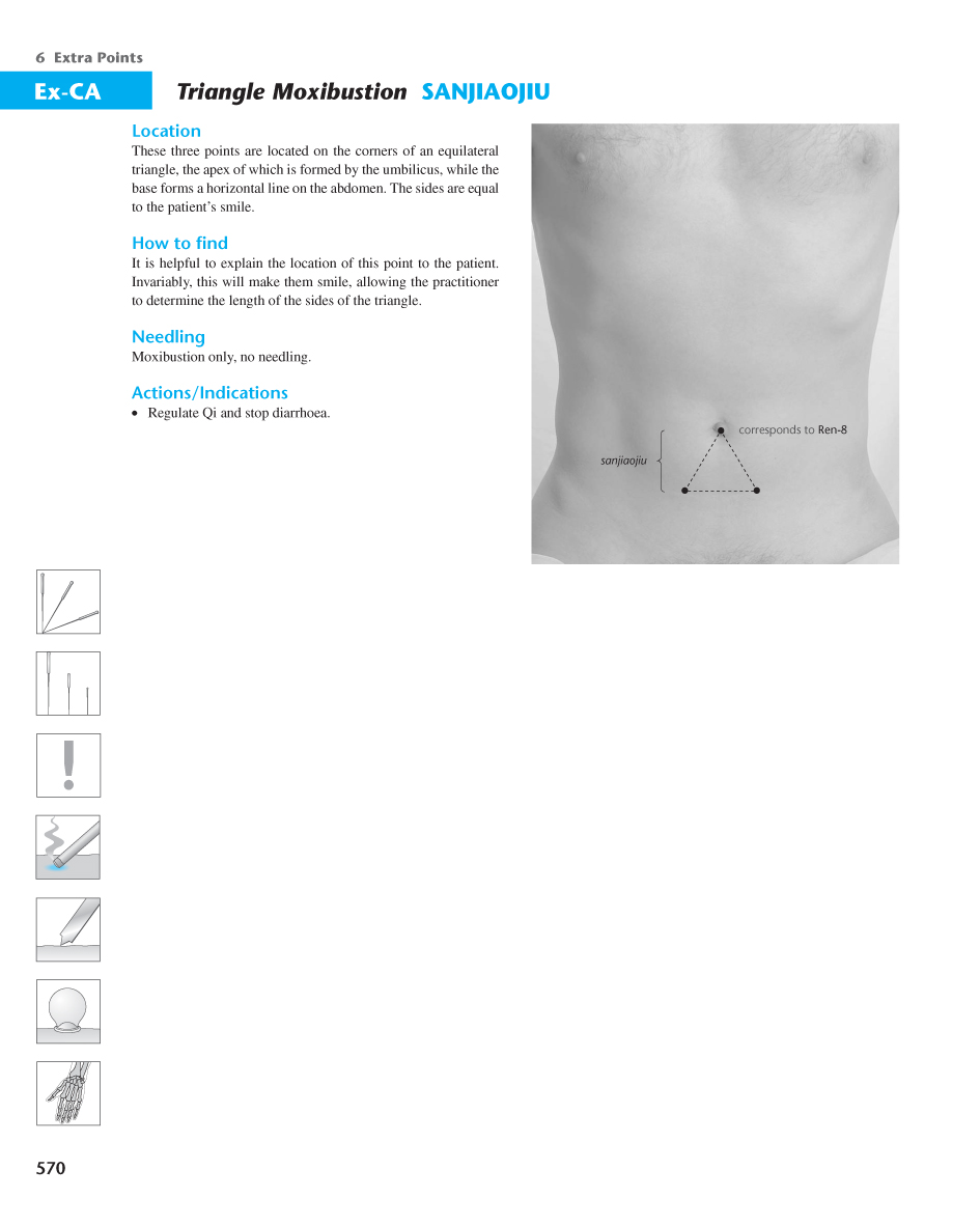 Acupuncture Masters: Acupuncture Points Database - Extra Points