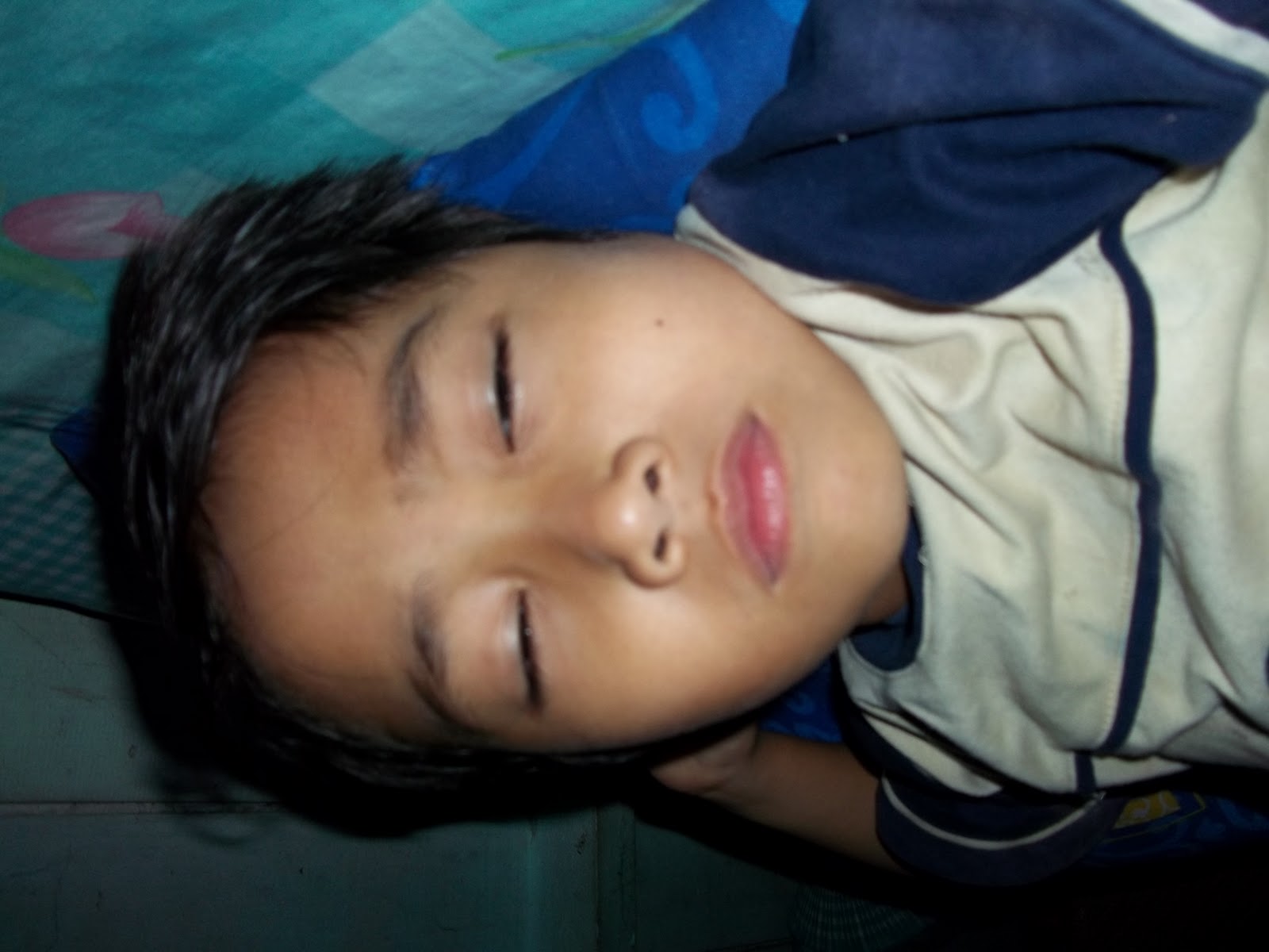 Rachma ♥ رَّحْمَ : Penyakit Gondongan (Mumps atau Parotitis) dan ...