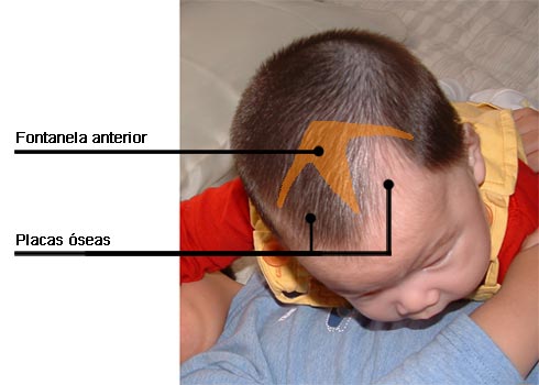 ENFERMERIA DEL RECIEN NACIDO,INFANCIA Y ADOLESCENCIA ( ERNIA ...