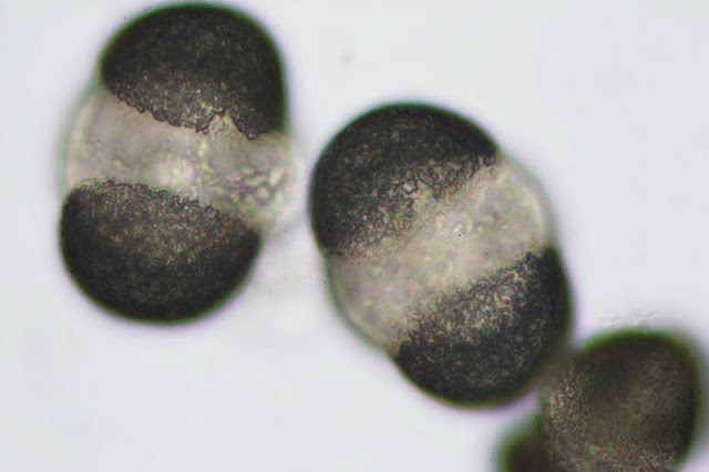 EL MUNDO MICROSCÓPICO DE LAS PLANTAS: Pinus sylvestris var. pirenaica ...