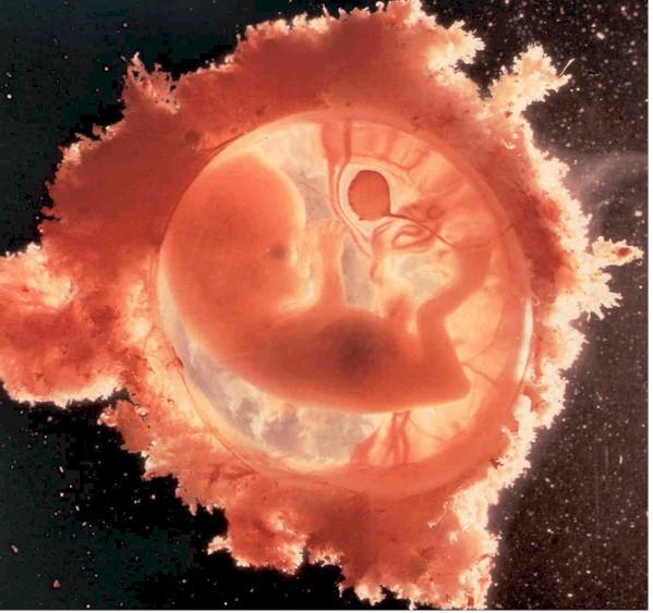 Maternellement Votre: 3ème Mois