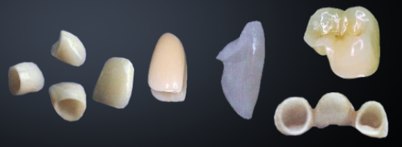 Laboratorio Dental Martin Falcon: In-Ceram