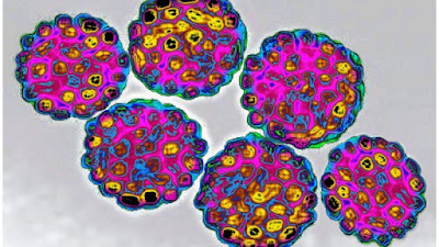 collage: VIRUS DEL PAPILOMA HUMANO. VIRUS DE TRANSMISIÓN SEXUAL