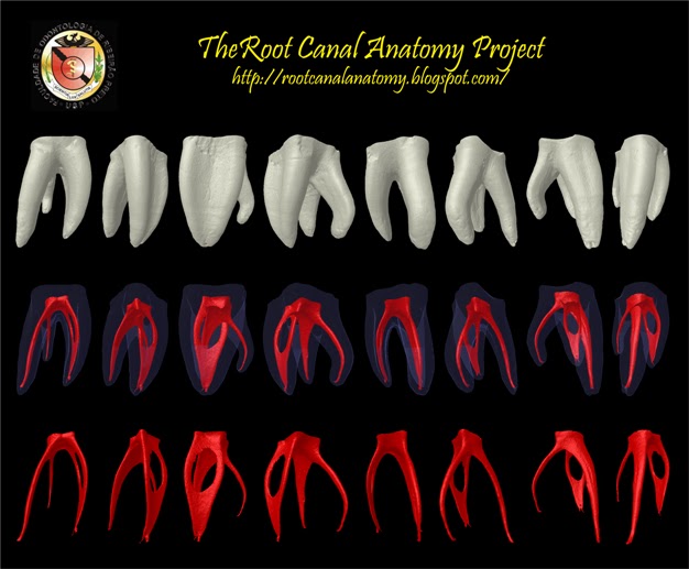 The Root Canal Anatomy Project: Mandibular Second Molar: Radix Entomolaris