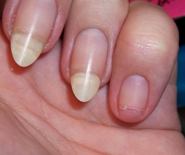 No Holos! Frankens and Nail Art Blog: Story of a Broken Nail