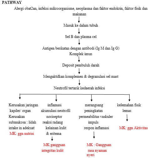 Asuhan Keperawatan: ASUHAN KEPERAWATAN PADA PASIEN SINDROM STEVENS JOHNSON