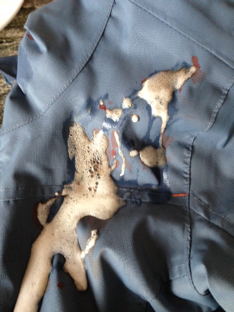 Cómo quitar manchas de sangre de la ropa