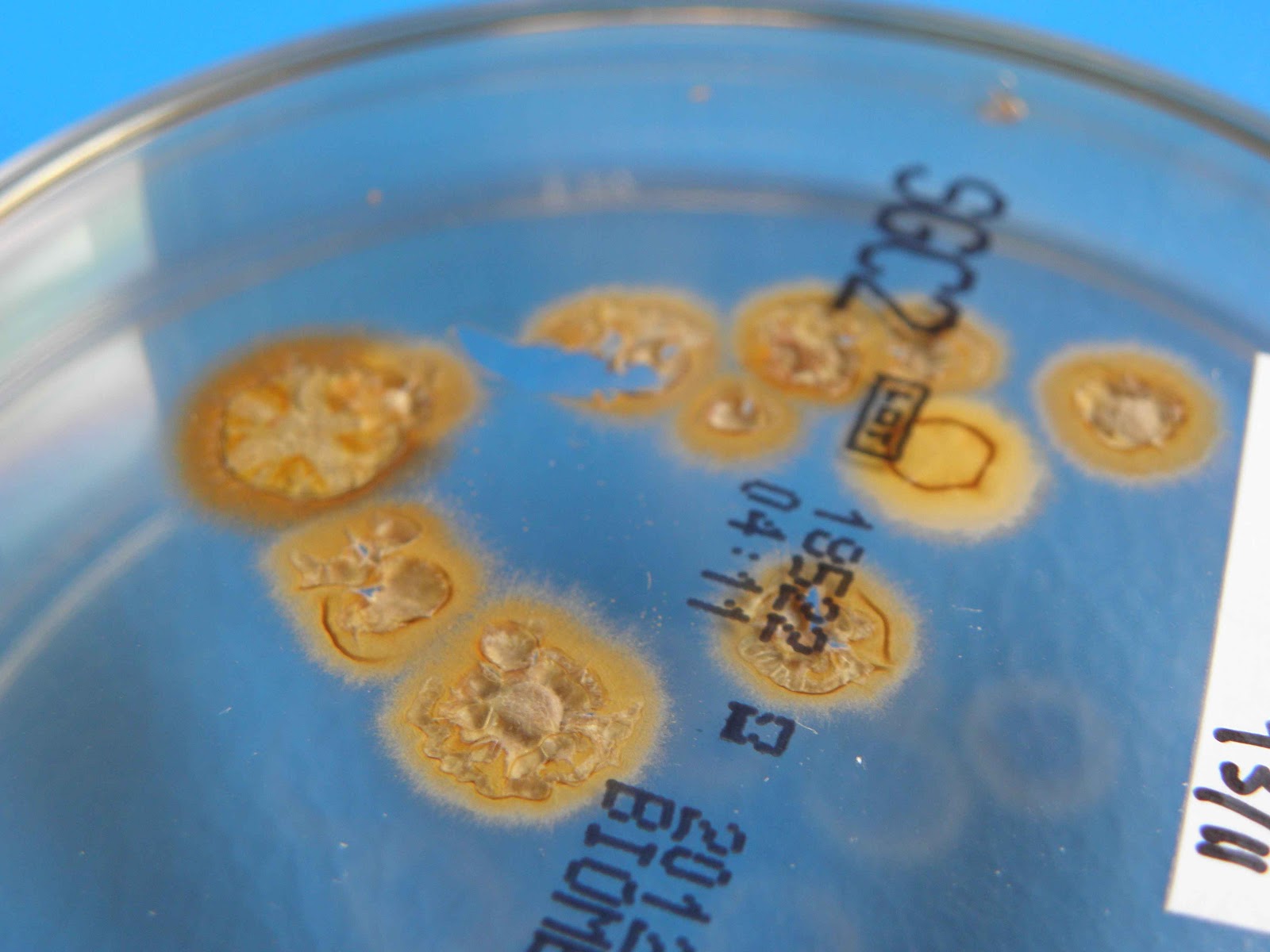 ATLAS MICOLOGIA: EPIDERMOPHYTON FLOCCOSUM