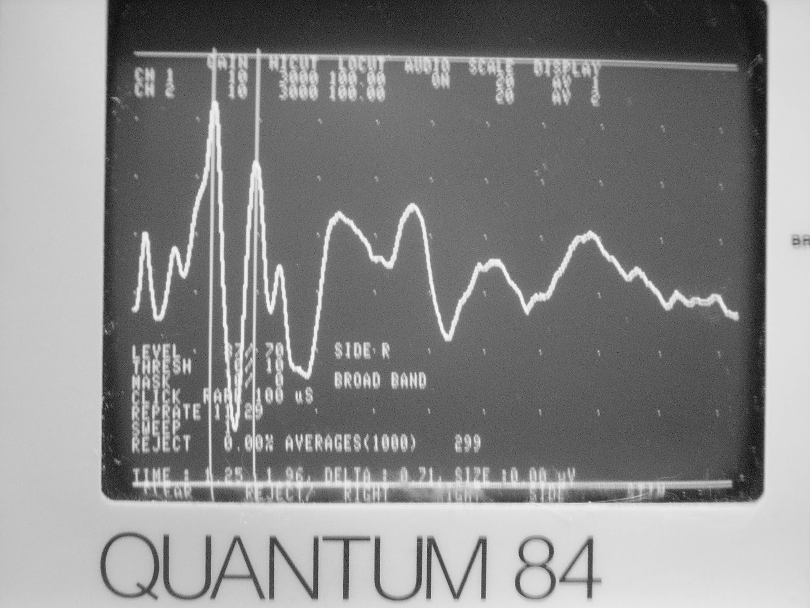 Michigan Veterinary Blog: What is BAER (Brainstem Auditory Evoked ...