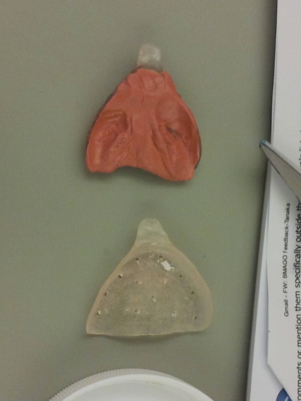 Our Cleft Story: NAM (Nasoalveolar Molding) & Taping