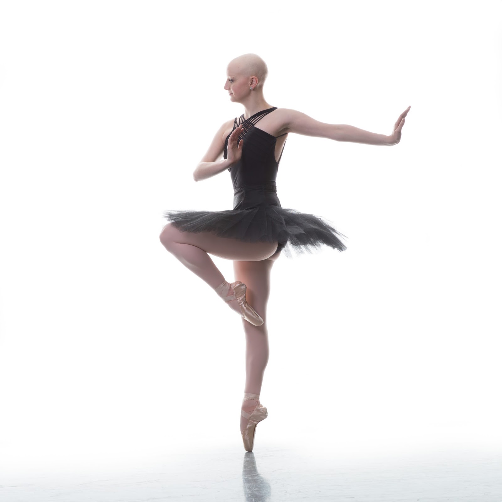 Tigerlily Foundation MY LIFE Blog: Bald Ballerina