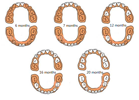 Children Dentist : Children Dentistry - Chennai Dental Centre