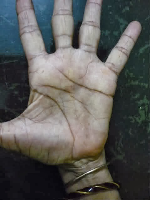 Broken Lines On Hand In Palmistry ~ INDIAN PALMISTRY | PALM READING ...