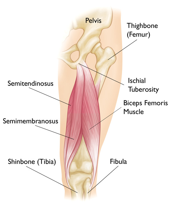 Rogaten Ja Ultraten Hamstring syndrooma Rogaten Ja Ultraten Hamstring syndrooma
