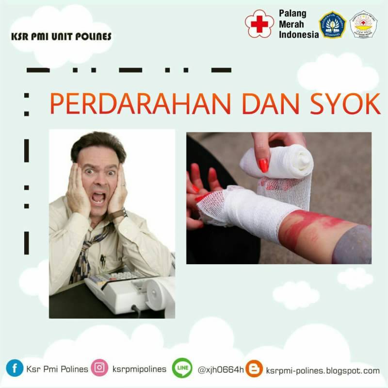 Materi & Tips Penanganan Perdarahan dan Syok