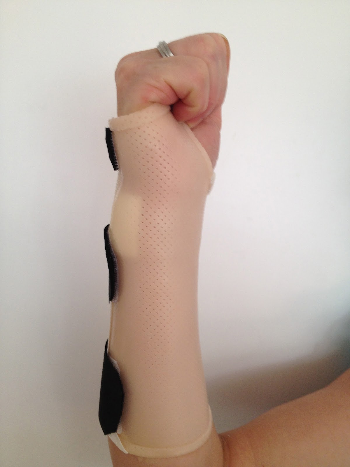 Orthèses sur mesure et appareillage personnalisé main poignet doigts ...