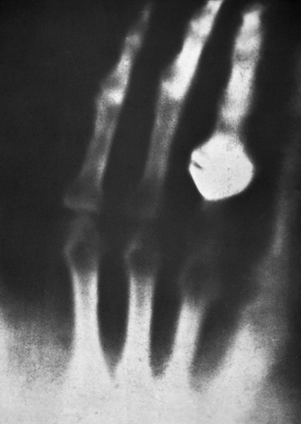 ABC Radiology Blog: Wilhelm Conrad Röentgen-Nobel Prize First Winner In ...