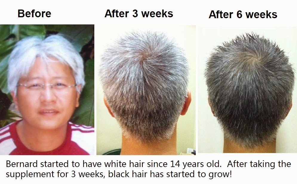 Cara Mengatasi Rambut Putih (Uban) Secara Alami Dengan Rebusan Kulit ...