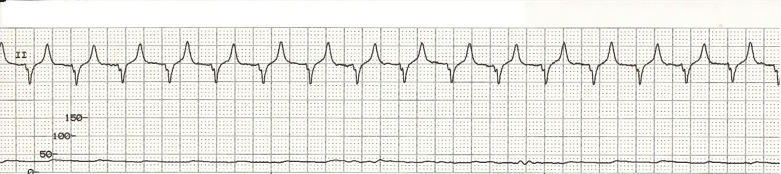 For in that sleep of death what dreams may come...