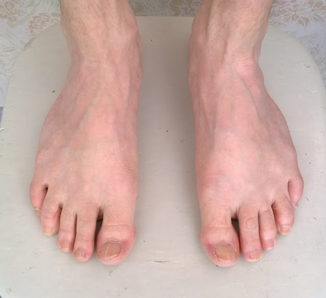 Kauneus blogi: JALKOJEN RAKENNEANALYYSI MIES 53V.