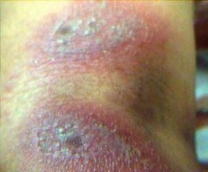 Tips Mengatasi dan Mengobati Serangan Serangga Tomcat