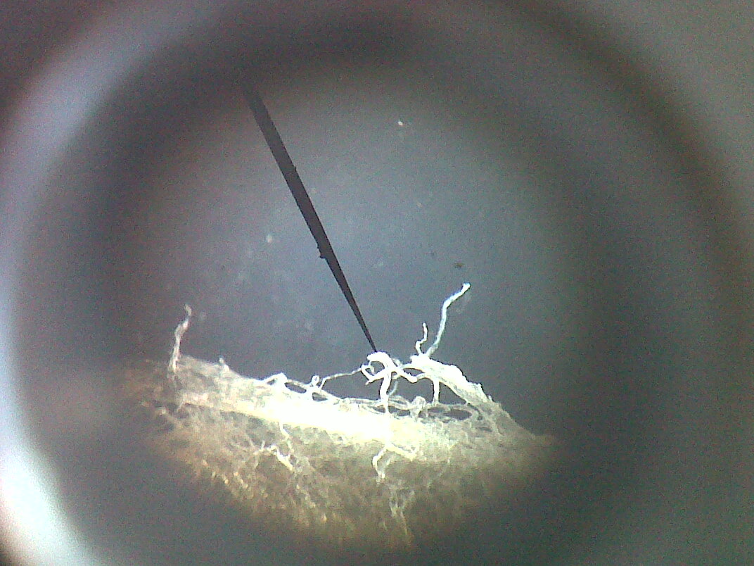 TUGAS SEKOLAH KU: MENGAMATI RHYZOPUS ORYZAE (JAMUR PADA TEMPE)